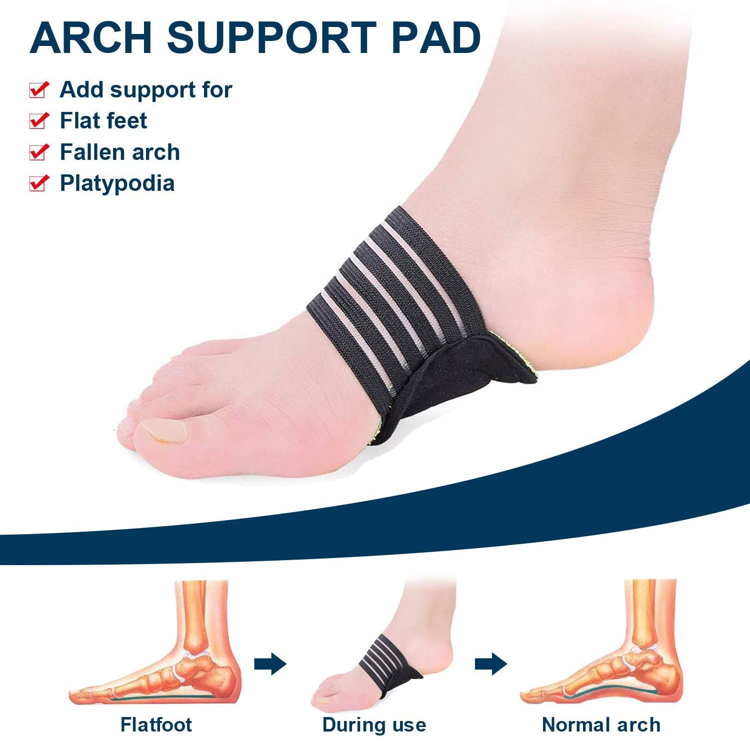 2 Pairs Extra Thick Cushioned Compression Arch Support with More Padded ...