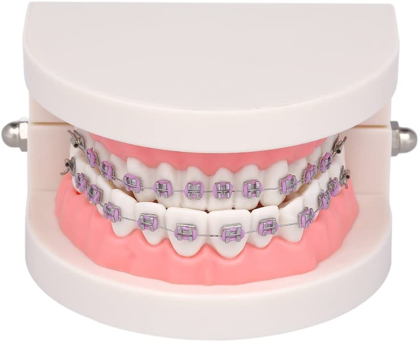 Anself Orthodontic Model Dental Teeth Standard Demonstration with ...