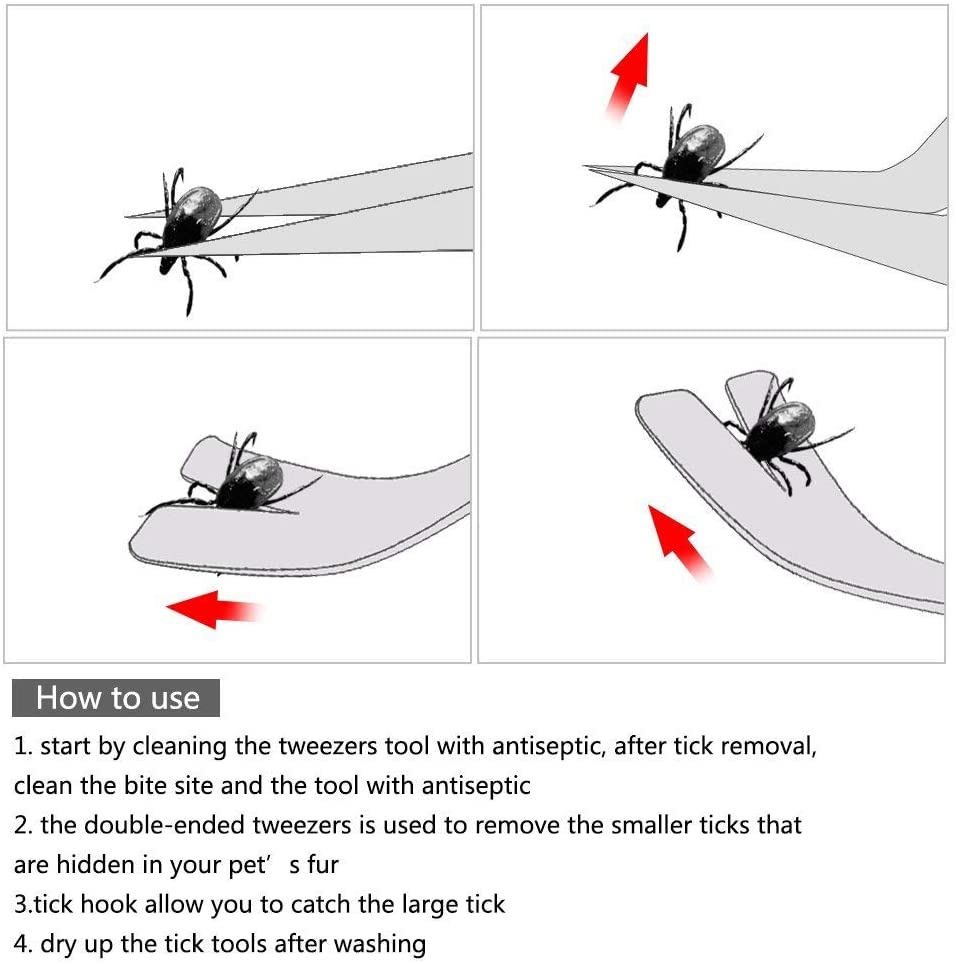 XUNKE Tick Remover, Tick Tweezers with 3 Set of Stainless Steel ...