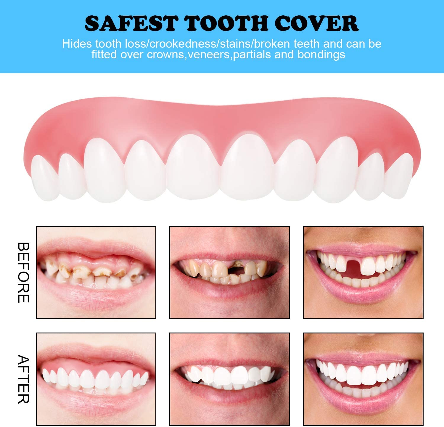 Instant Veneers Dentures Covering Missing Teeth Denture Tooth Temporary ...