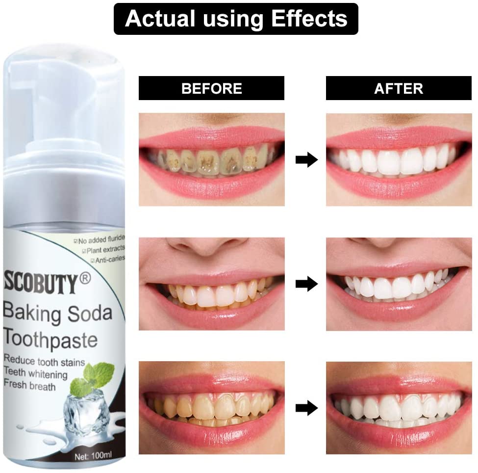 Soda Toothpaste,Foam Toothpaste,Teeth Whitening Toothpaste,Whitening ...